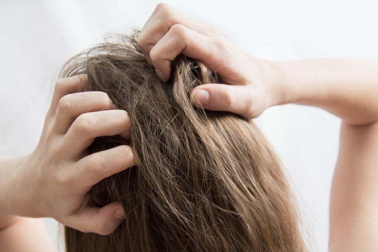 What You’re Itching to Know About Lice – Parenting in Manitoba